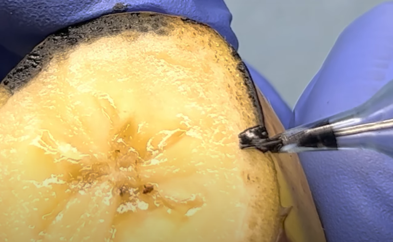 How Deep Does a Tattoo Needle Go? - TattooProfy