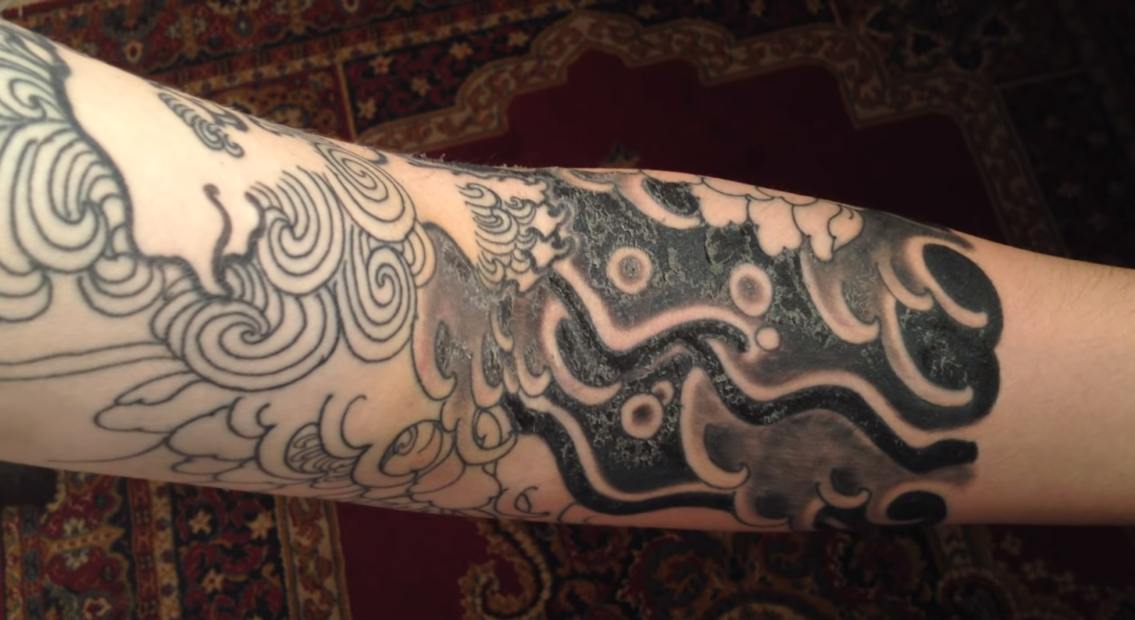 Yellow Bruising Around Tattoo: What to Do? - TattooProfy